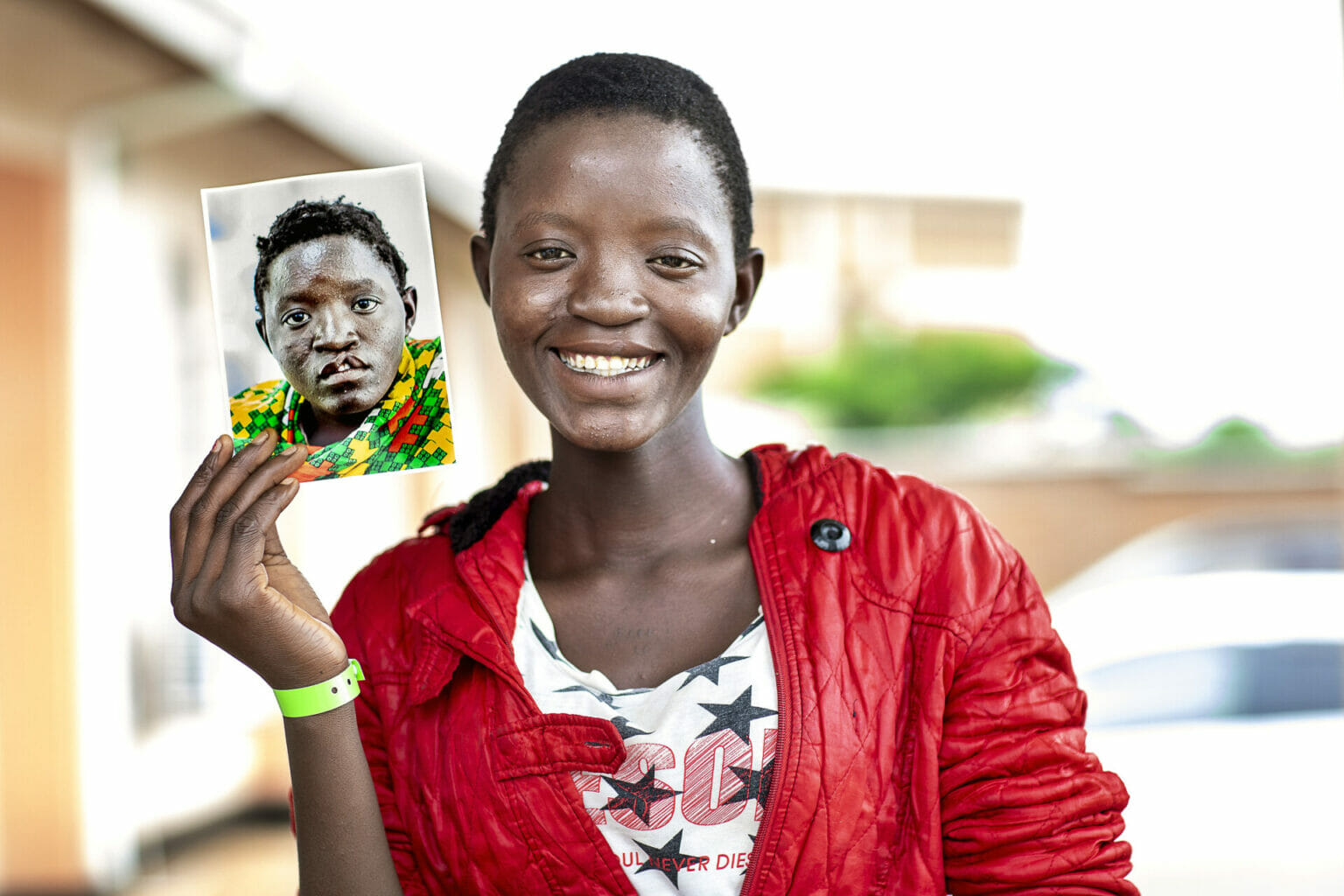 Operation Smile Malawi – Operation Smile Malawi