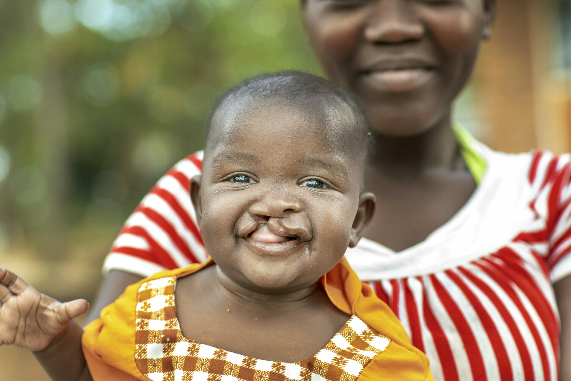 Programs – Operation Smile Malawi
